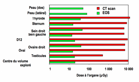 EOS – Centre de Radiologie Cannes Croisette
