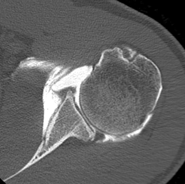 Arthro Scanner – Centre de Radiologie Cannes Croisette